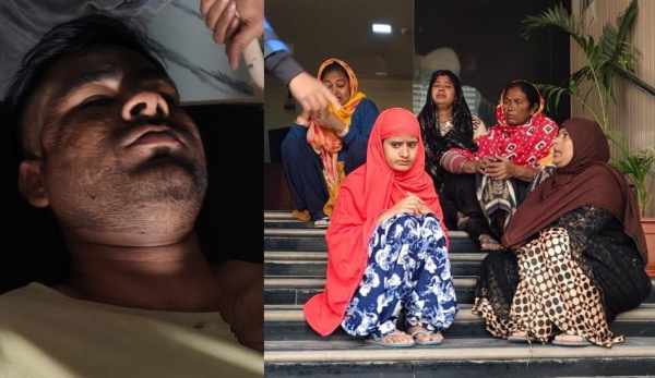 Palamu Crime : बाइक सवार अपराधियों ने युवक को मारी गोली, जांच में जुटी पुलिस - The Photon News